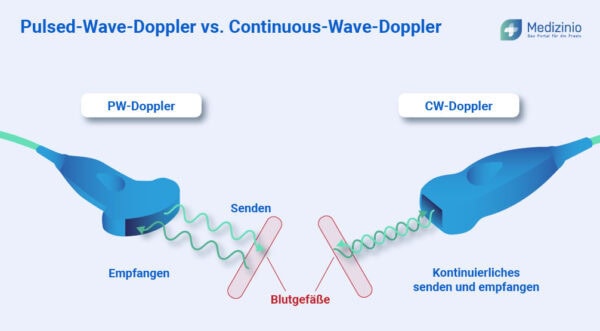 Der CW-Doppler-Ultraschall (Continuous-Wave-Doppler)