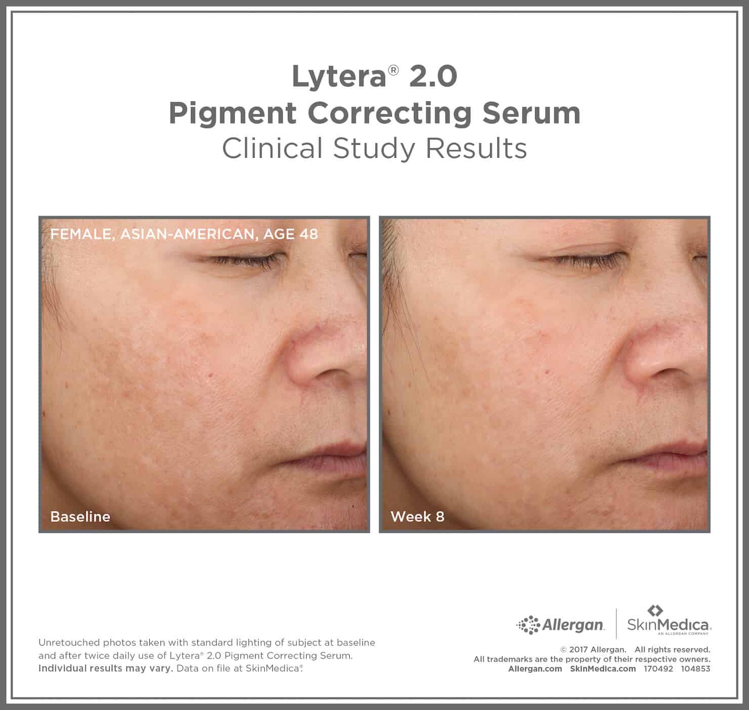 Lytera® 2.0 Pigment Brightening Serum by SkinMedica® | Buy Online in Canada
