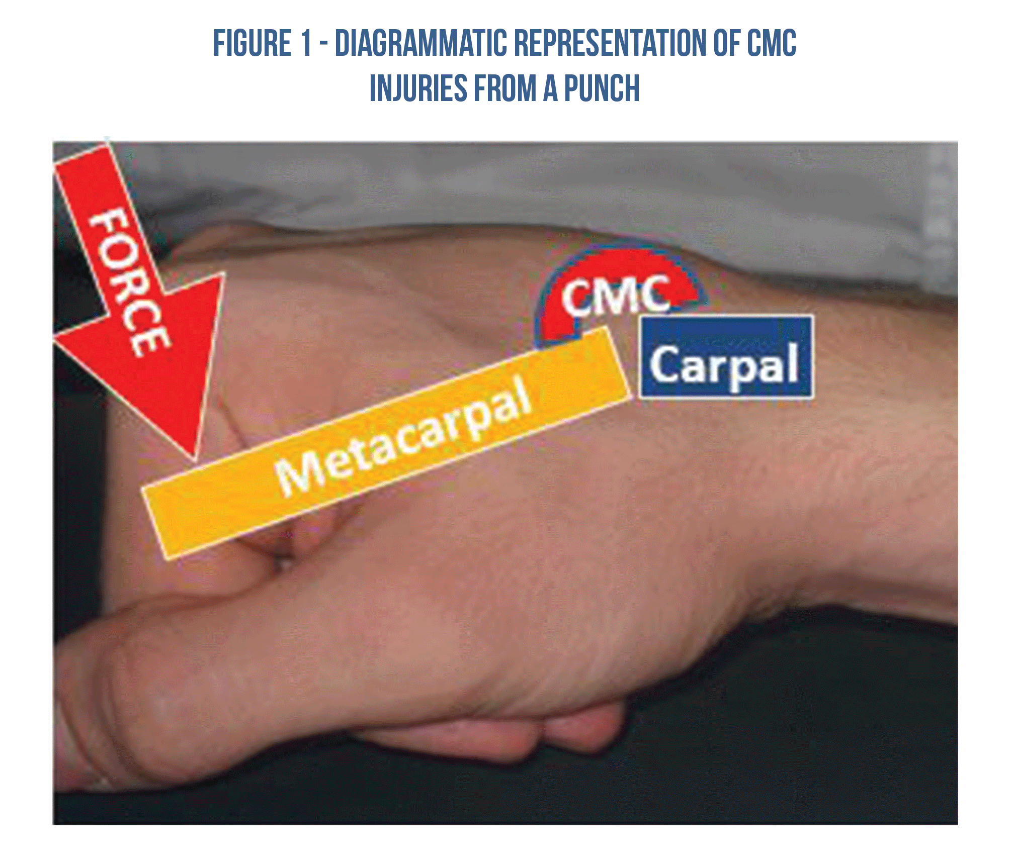 carpometacarpal joint function