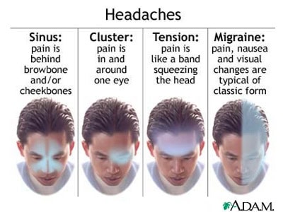cluster headaches driving