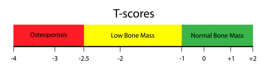 normal bone scan t score