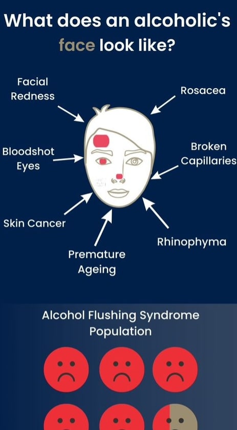 What Does an Alcoholics Face Look Like? - Abbeycare
