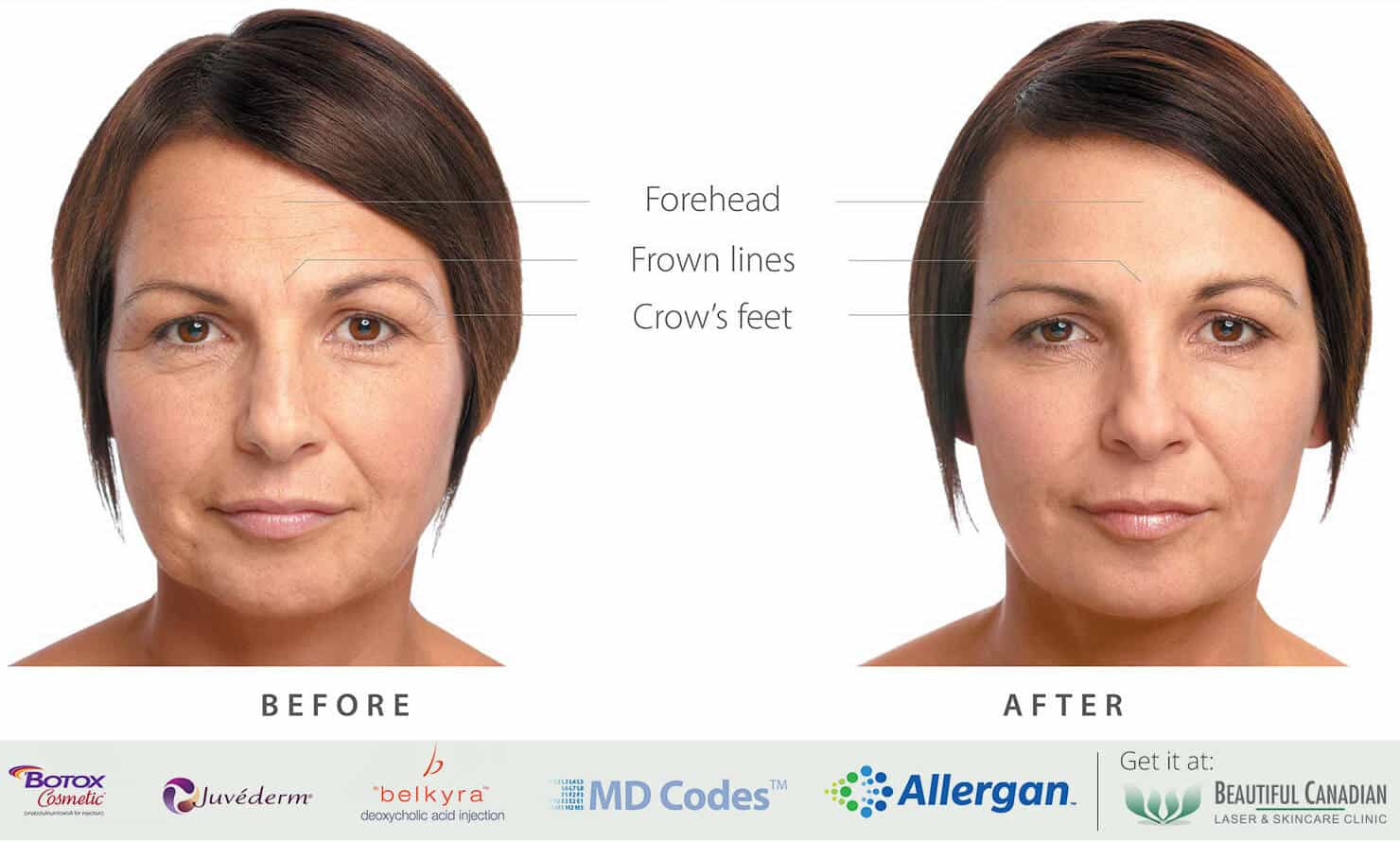 10 Non-surgical, Anti-Aging Treatments Proven to Work, According to Science