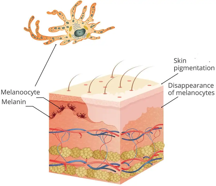 Melanocytes Diagram